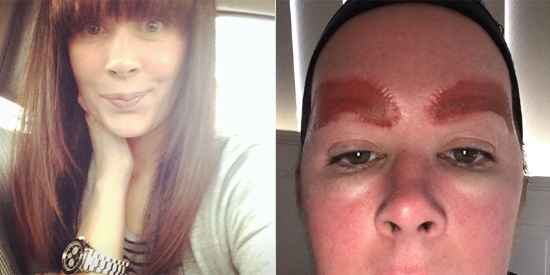 This is What a Bad Reaction to Microblading Looks Like - Microblading ...